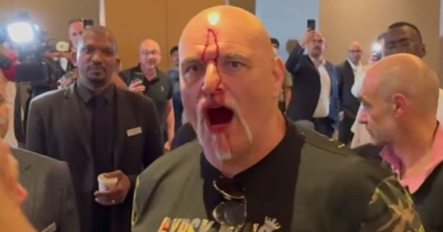 Man Headbutted By John Fury Discusses Shock Incident
